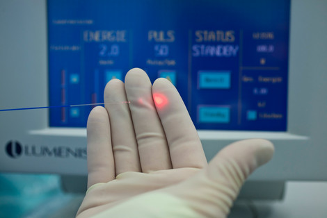 HoLEP Holmium-Laser-Operation bei gutartiger Vergrößerung der Prostata (BPH)
